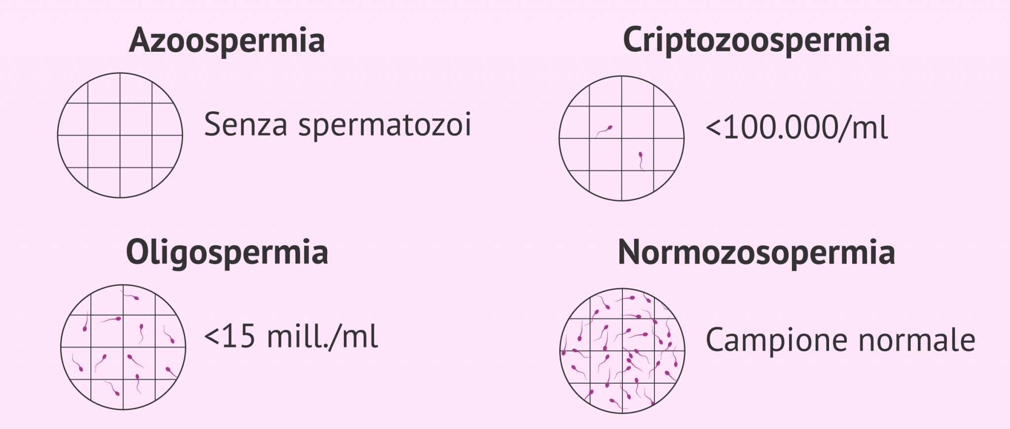 Cos'è l'azoospermia? - Cause, diagnosi e trattamento